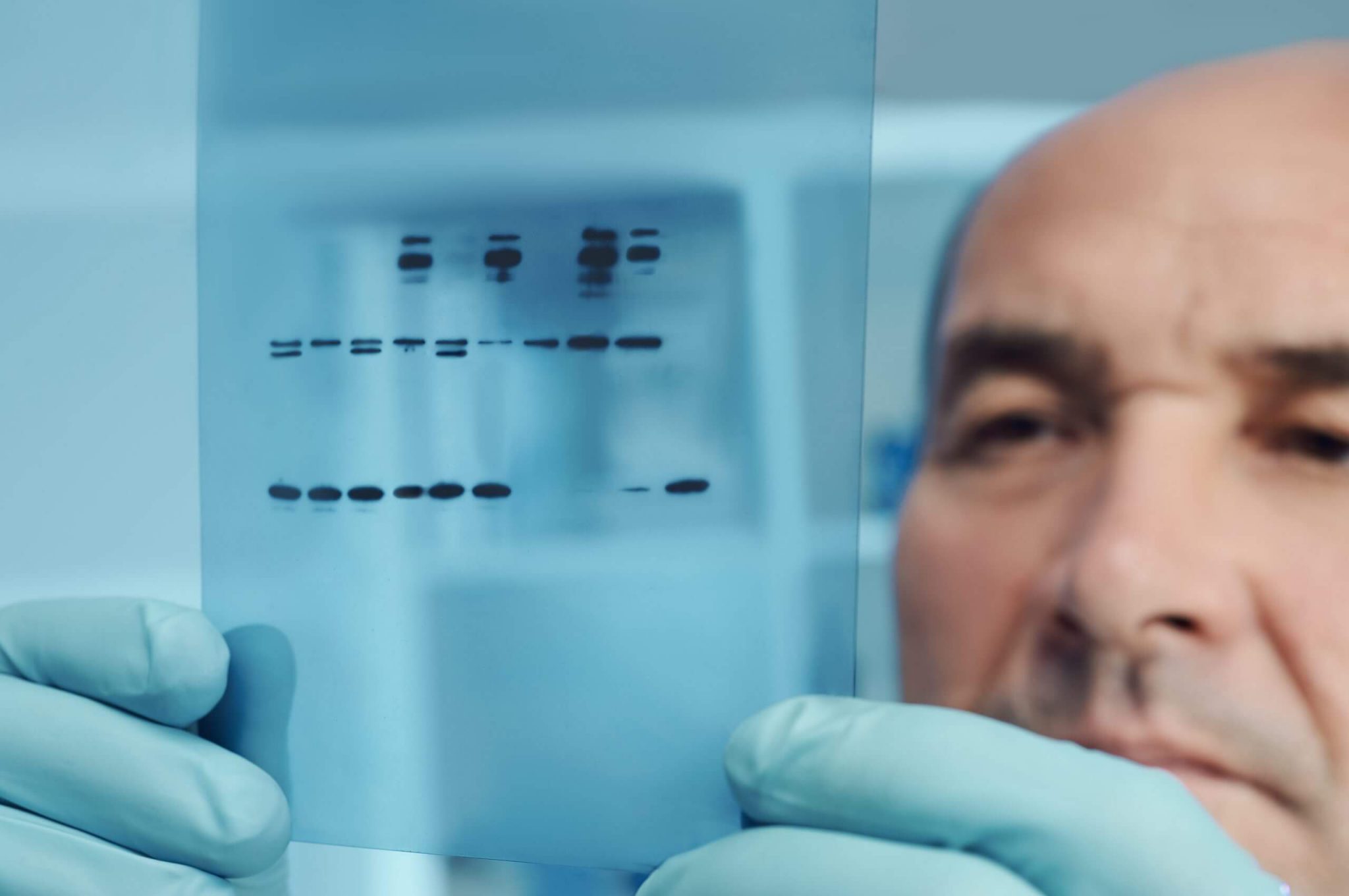 The Concept, Processes, and Applications of Western Blotting