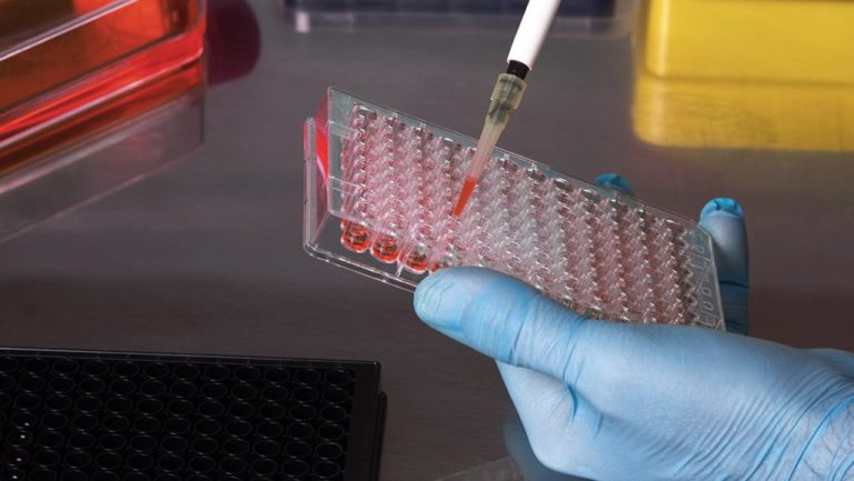 ELISpot Assay | Principle, Procedure, Benefits, and More